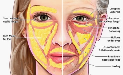 Understanding facial ageing – SkinLab