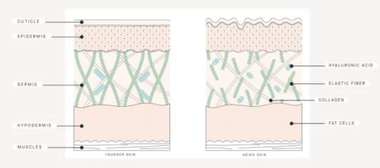 Skin and Tissue Laxity – SkinLab